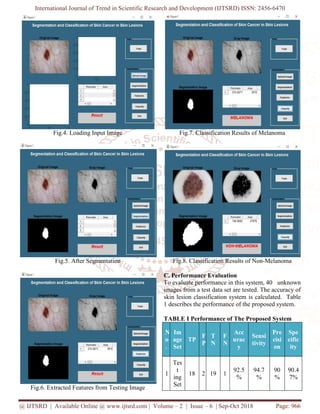 Skin Cancer Detection using Digital Image Processing and Implementation ...