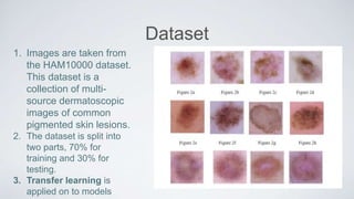 Ghaziabad, India - Early Detection of Various Types of Skin Cancer ...