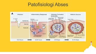 1587128014131 presentasi abses pedis | PPTX