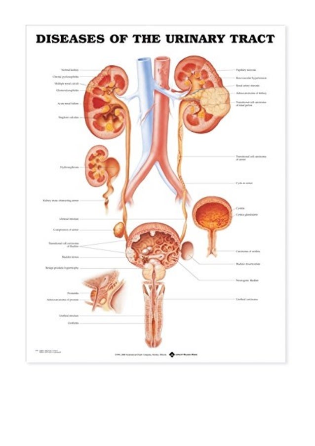 (2000) Diseases of the Urinary Tract Anatomical Chart (PDF) by Anato…