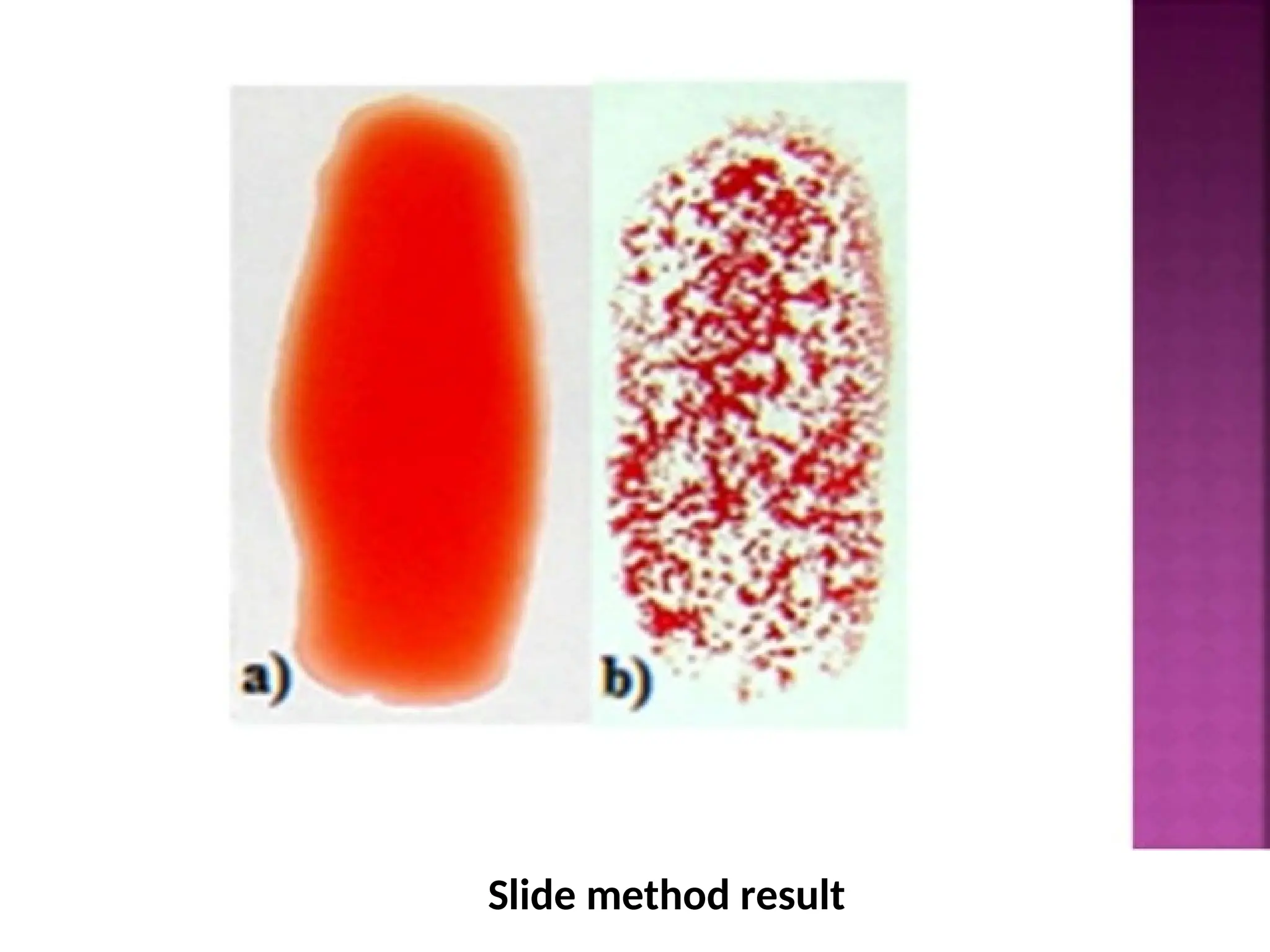 Laboratory methods of Blood Grouping techniques.p | PPT