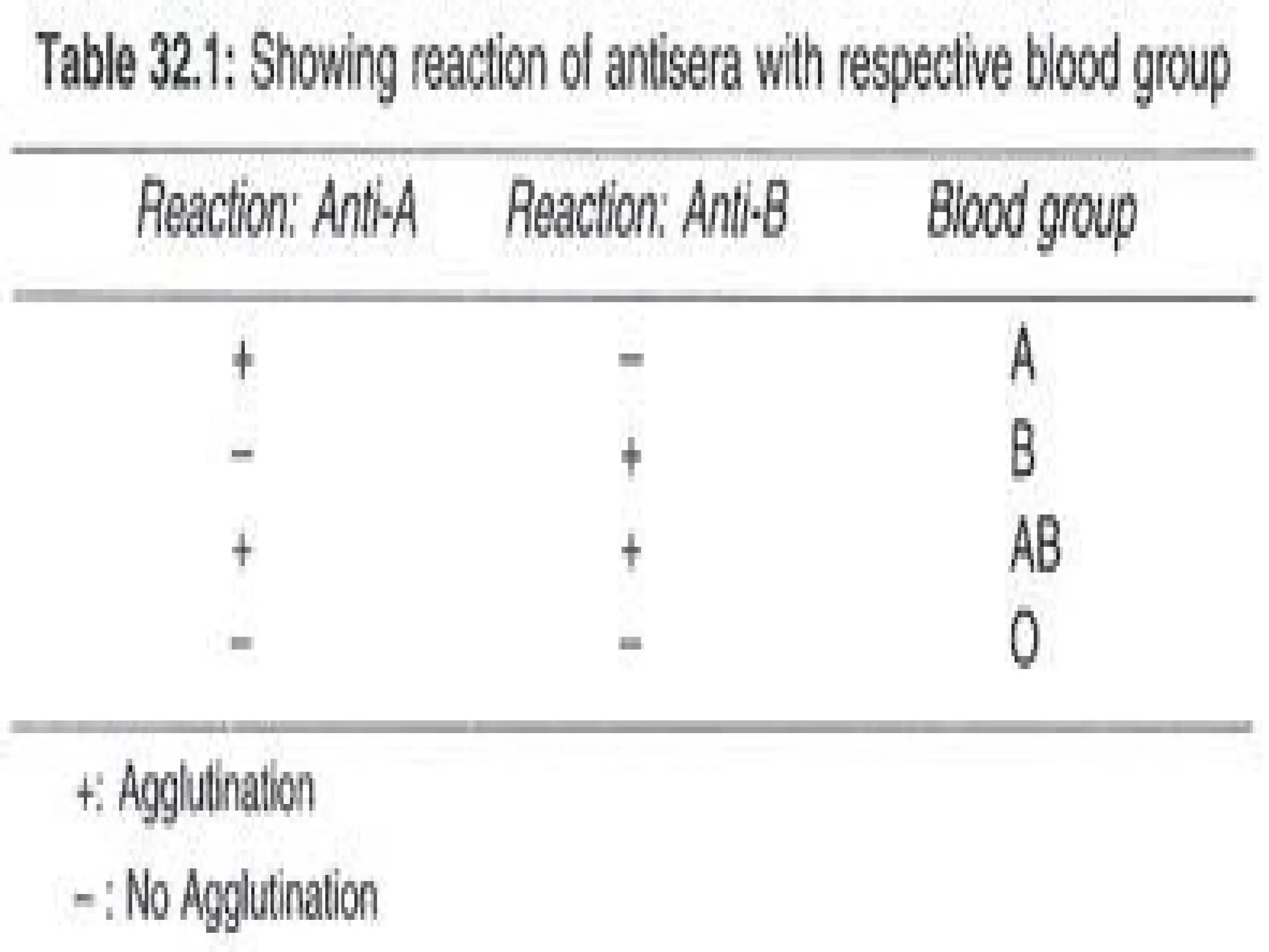 Laboratory methods of Blood Grouping techniques.p | PPT