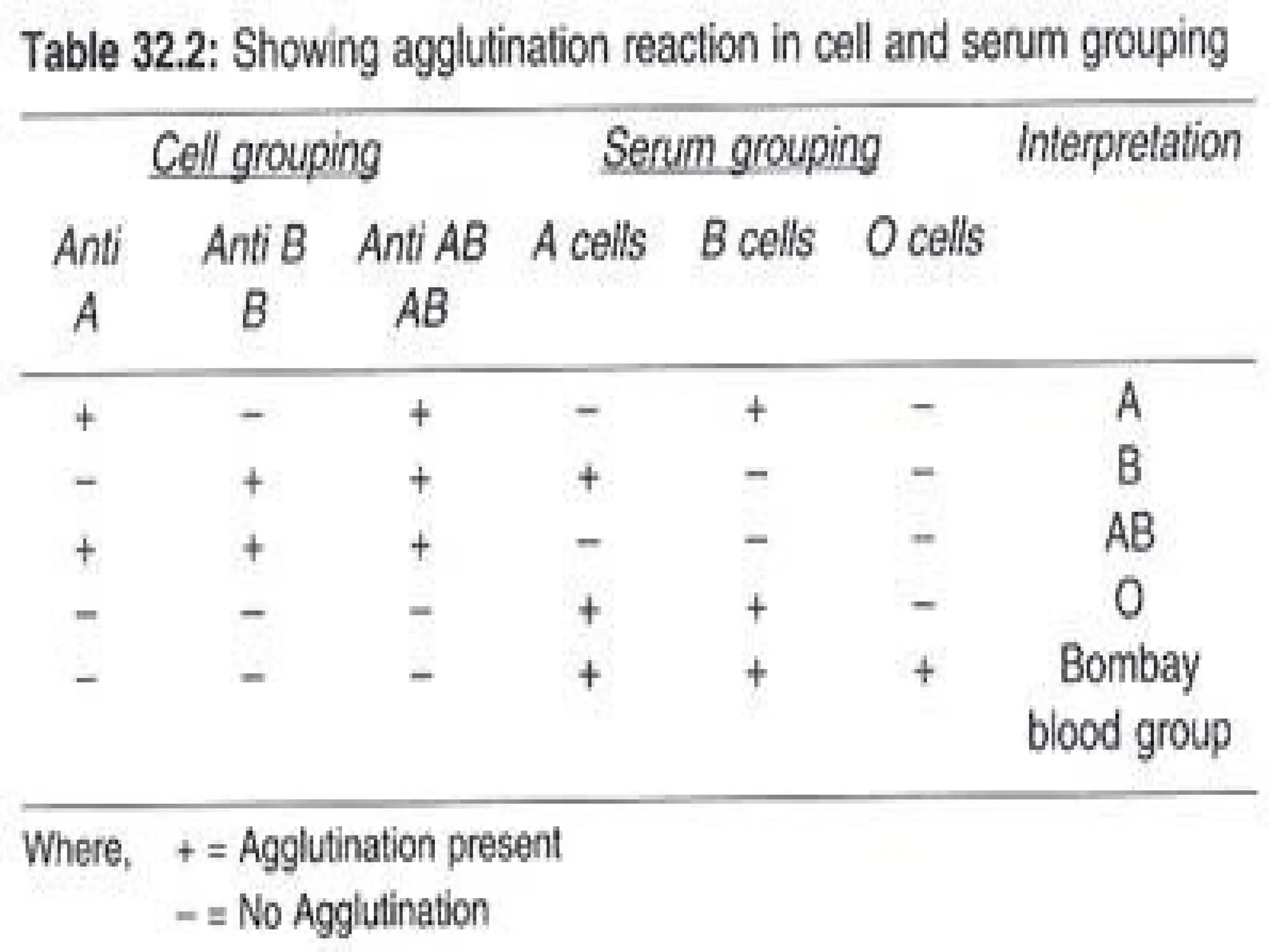 Laboratory methods of Blood Grouping techniques.p | PPT