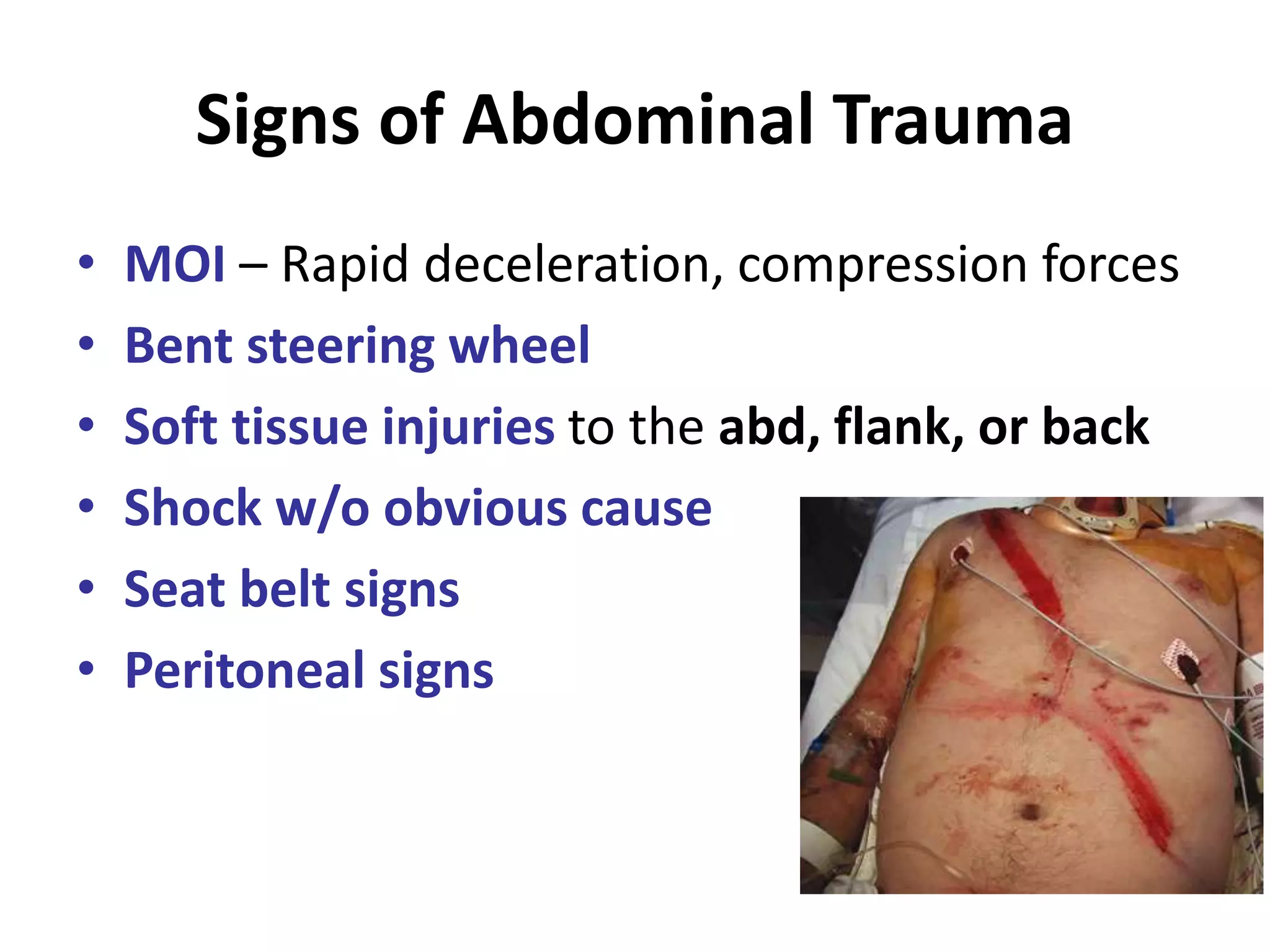 1588832705-abdominal-injuries-in-sports.pptx