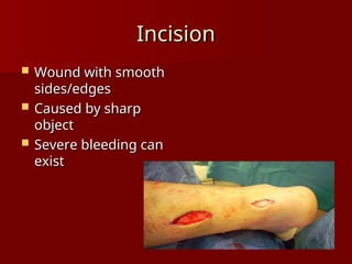 1588933324-classification-of-wounds).ppt