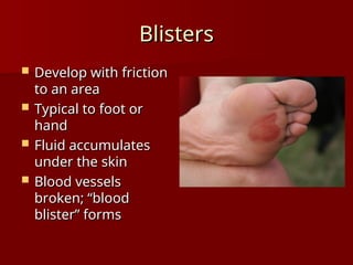 1588933324-classification-of-wounds).ppt