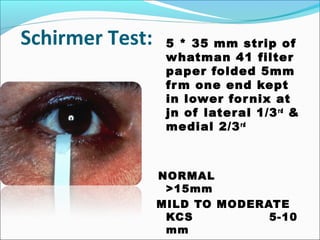dry eye | PPT