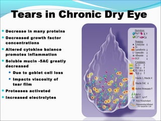 dry eye | PPT