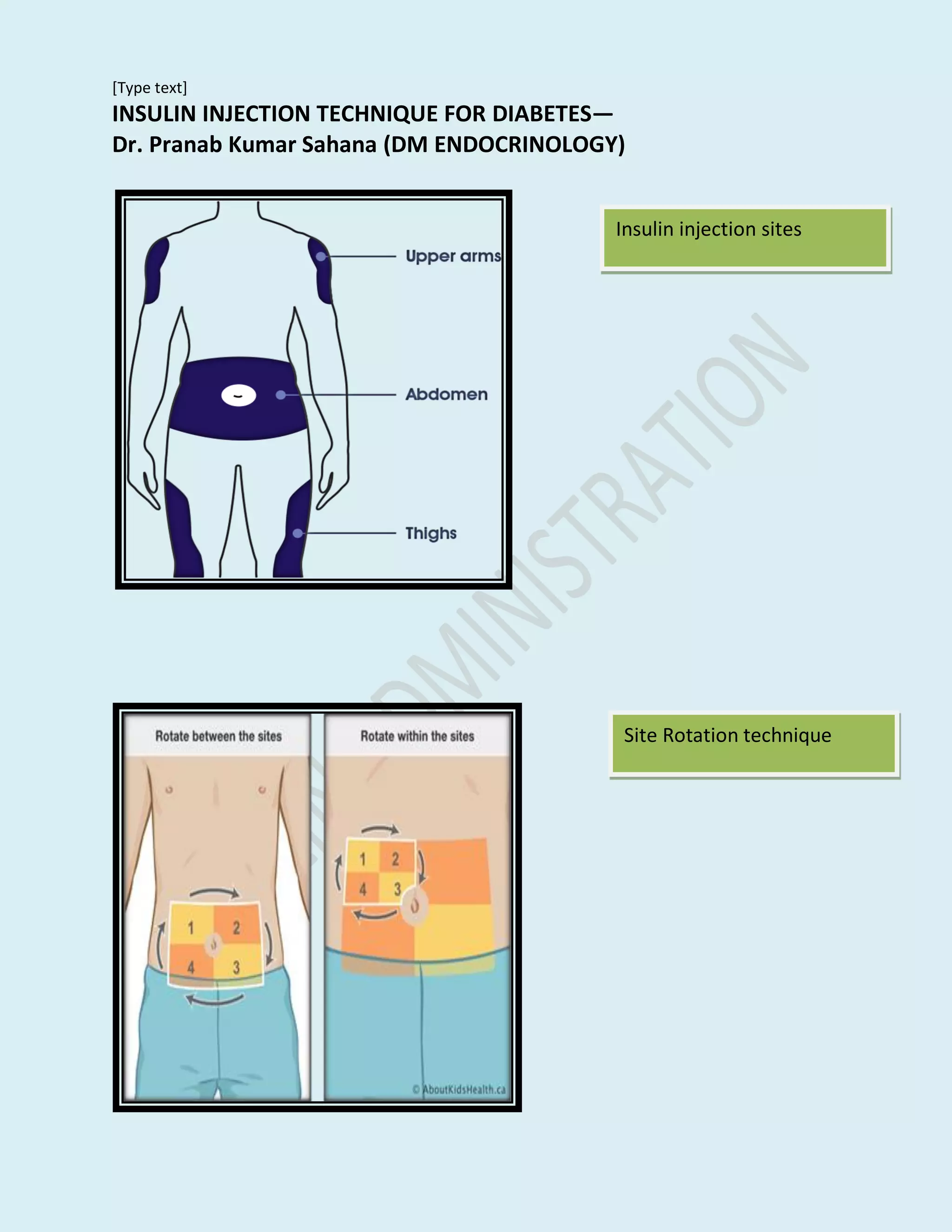 1592880638275 insulin injection technique | PDF