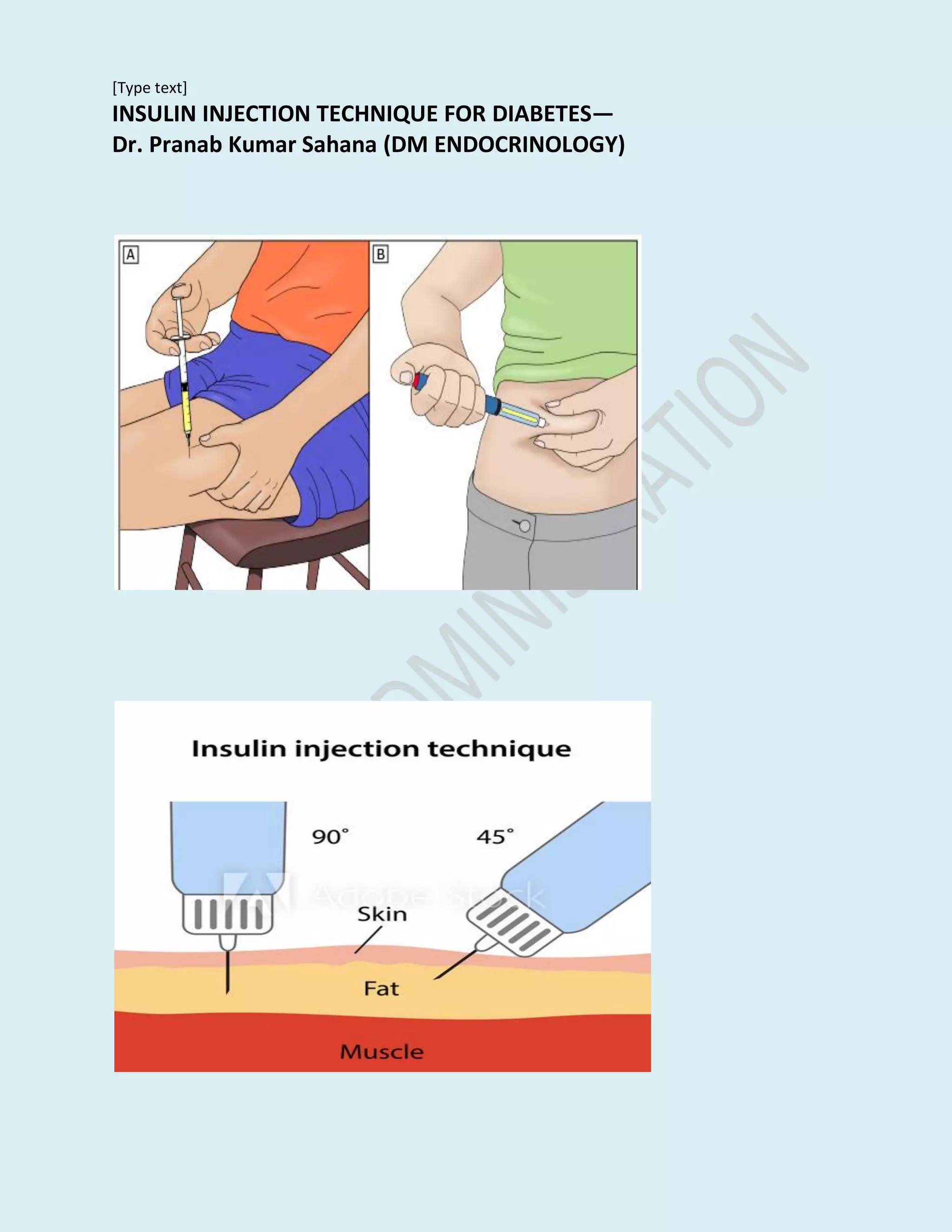 1592880638275 insulin injection technique | PDF