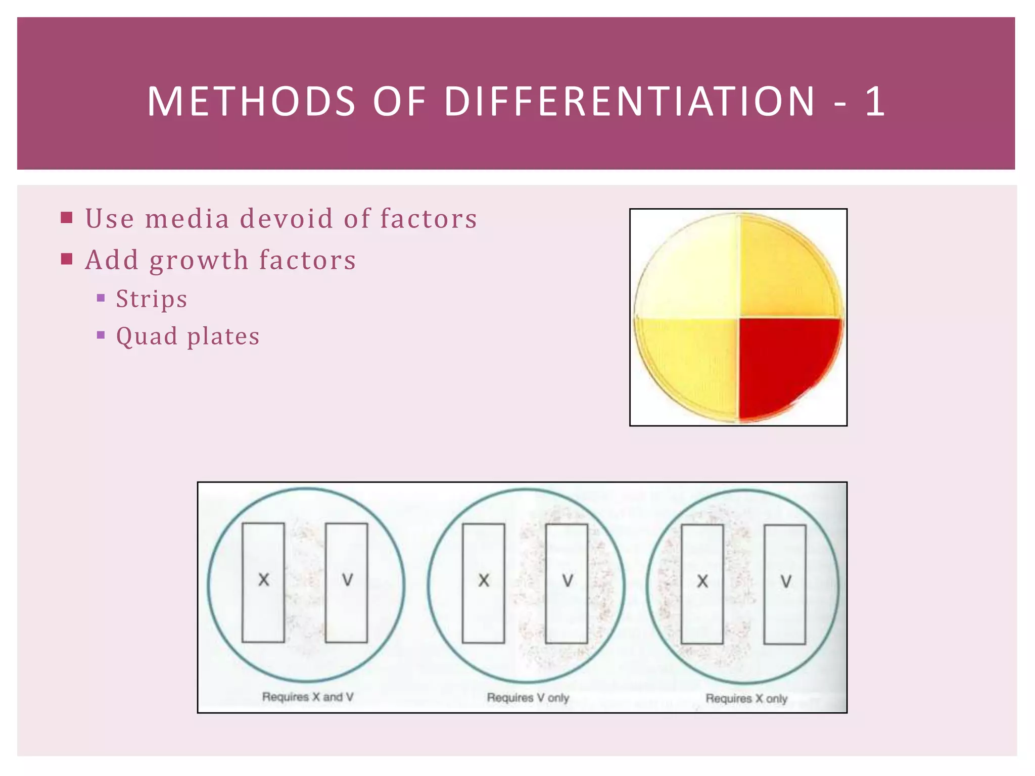 15a -chapter_18_-_haemophilus_species | PDF
