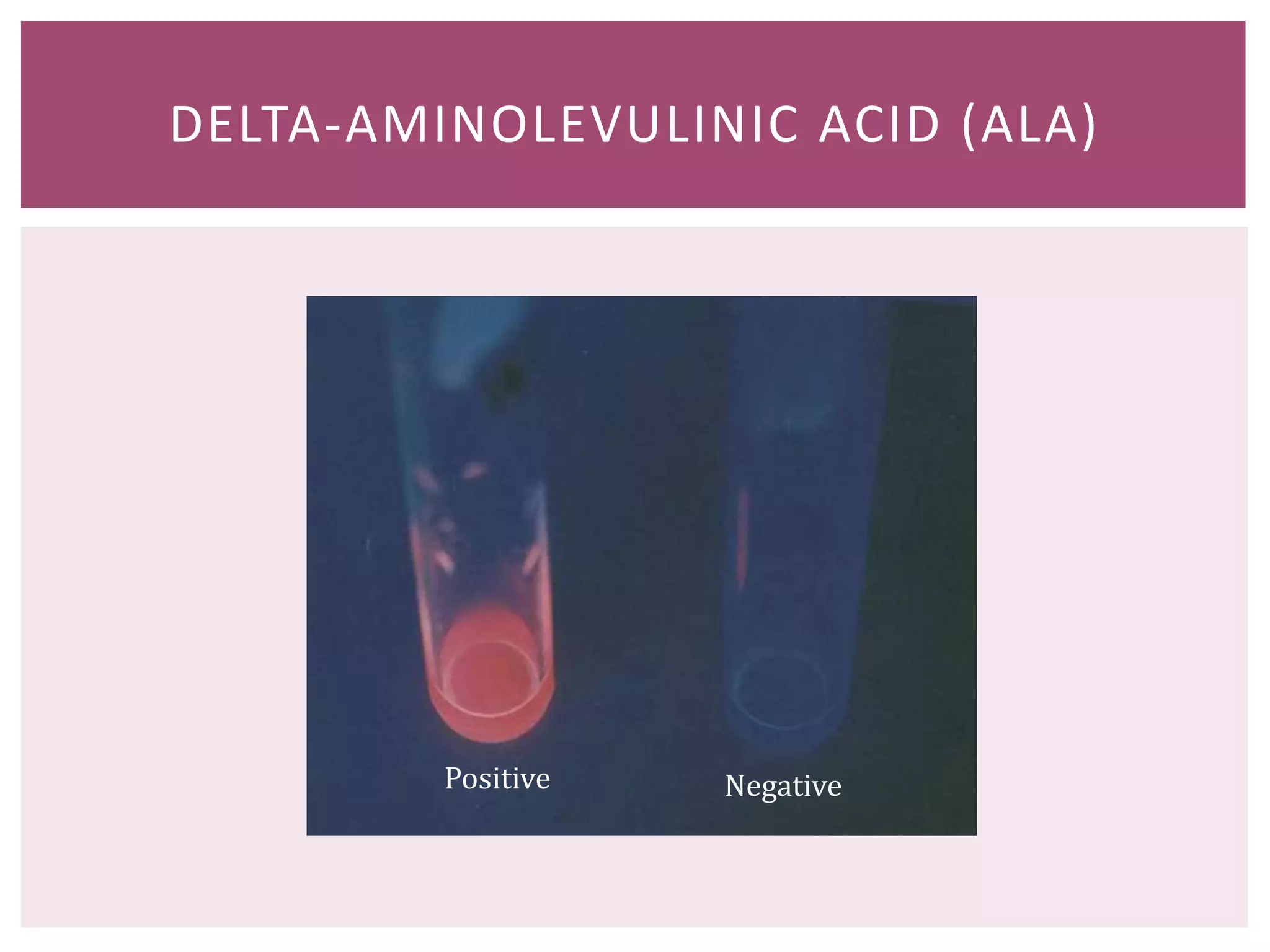 15a -chapter_18_-_haemophilus_species | PDF