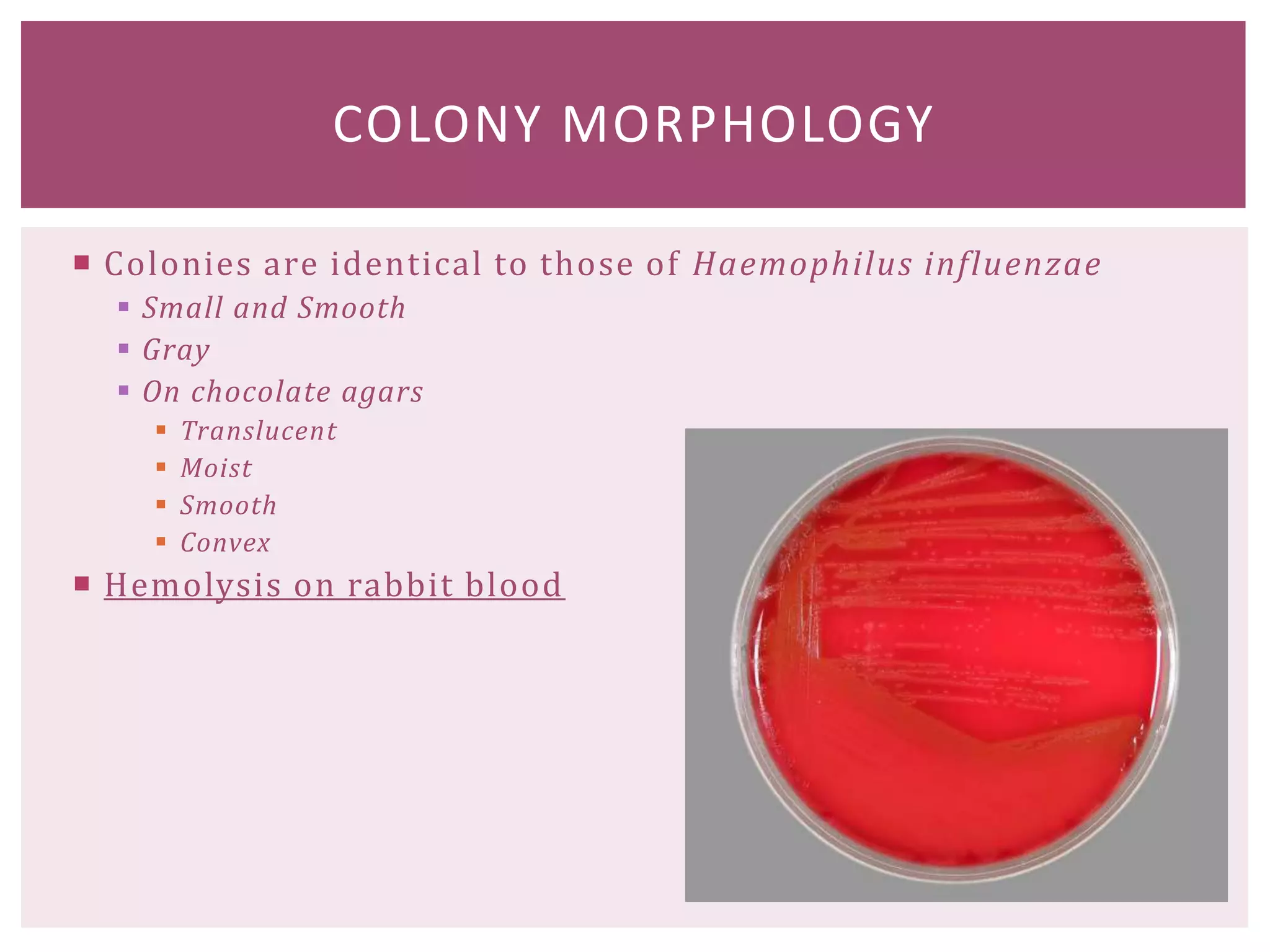 15a -chapter_18_-_haemophilus_species | PDF