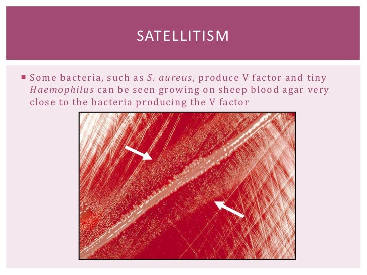 15a -chapter_18_-_haemophilus_species