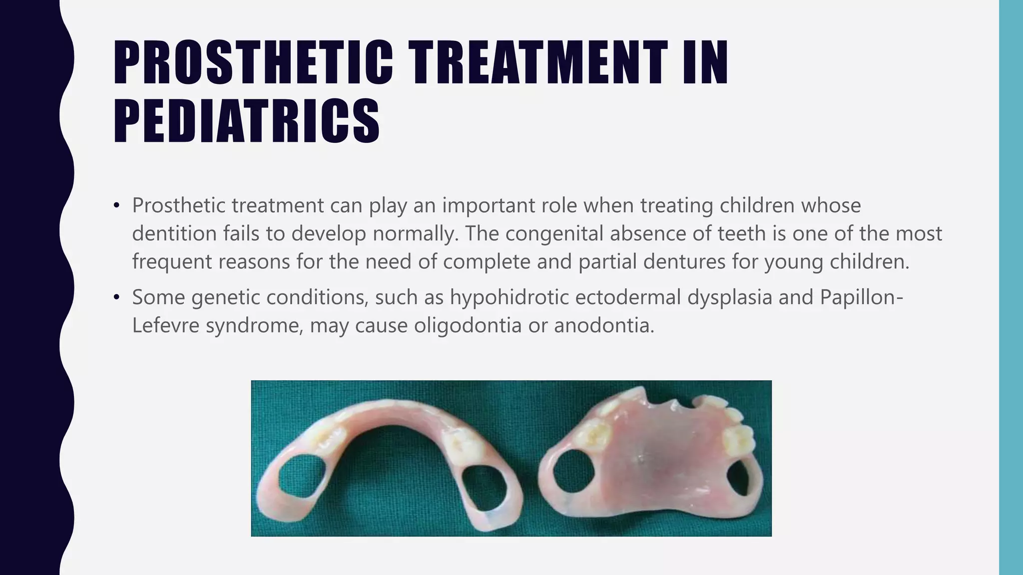 prosthetic tratment of pediatric patient | PPTX