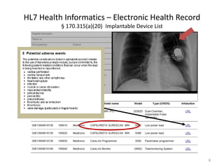 Health Informatics and implantable medical devices | PPT