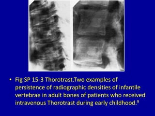 15 bone within-a-bone appearance | PPT