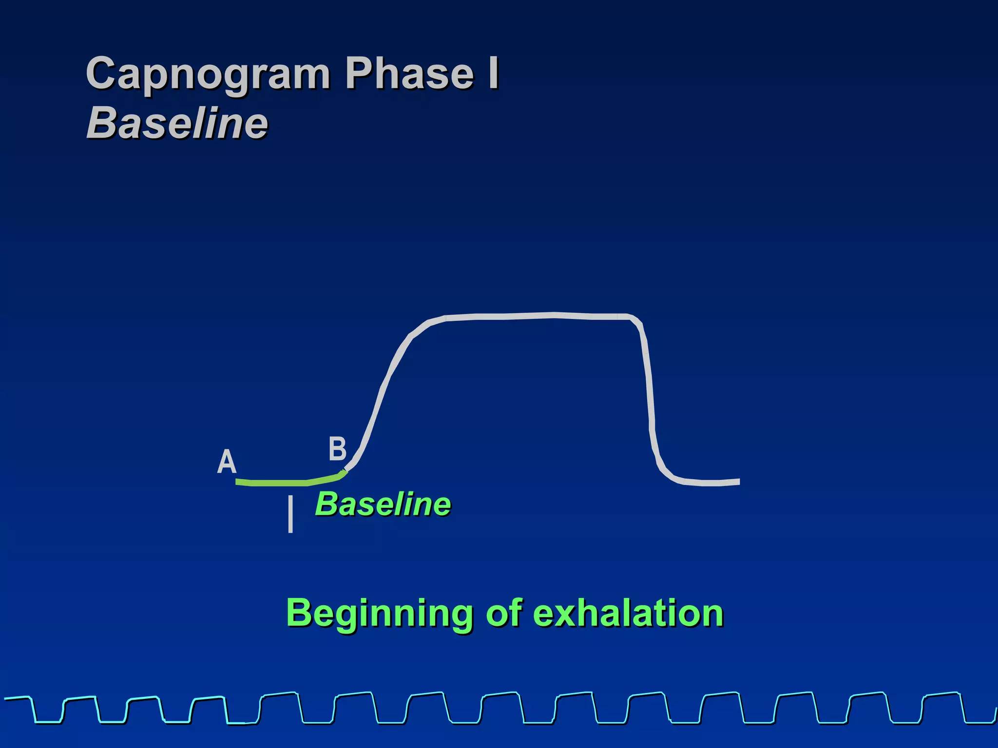 15 capnography part2 introduction | PPT
