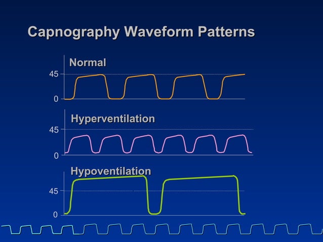 15 capnography part2 introduction