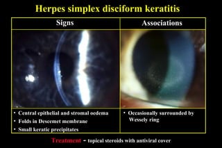 corneal infections | PPT