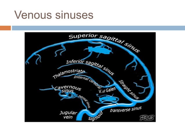 15 dural venous sinuses | PPTX | Ear, Nose and Throat Conditions ...