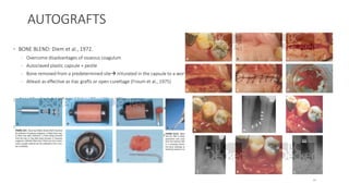 Regenerative Periodontal Surgery | PPTX