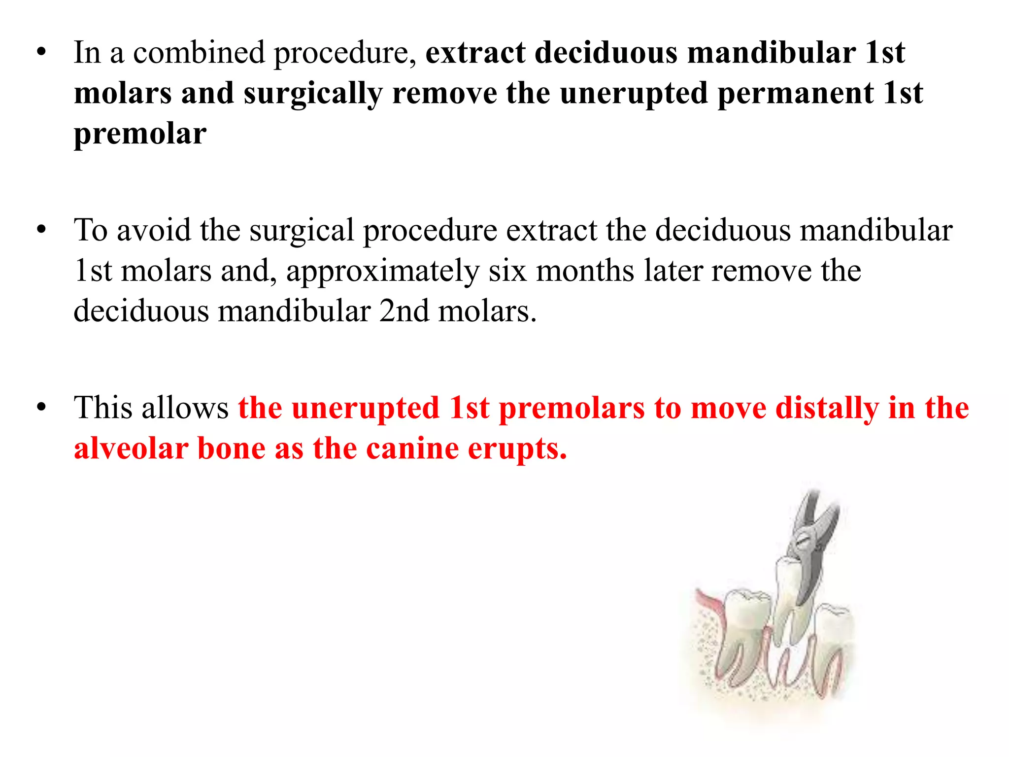 serial extraction | PPTX