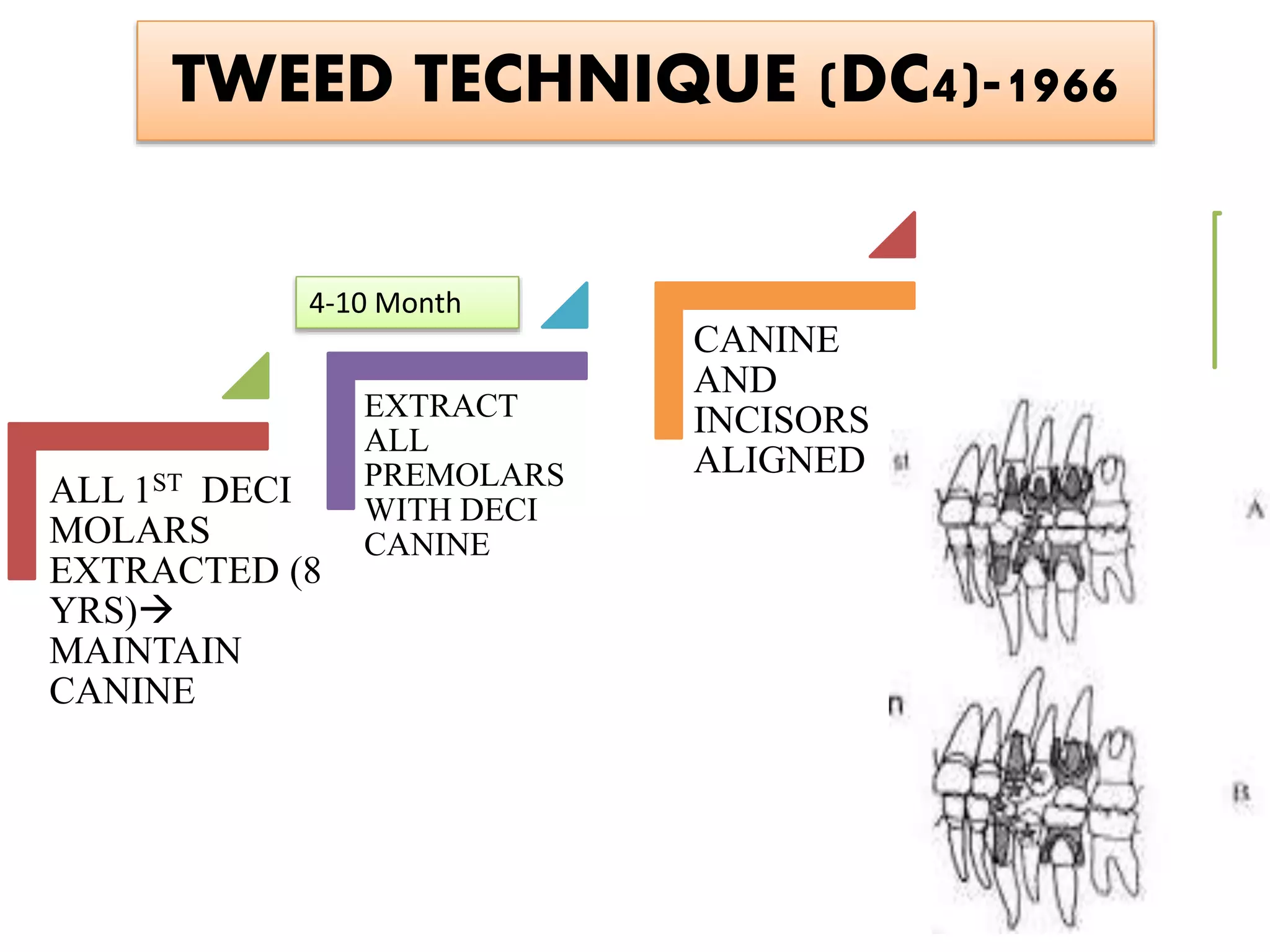 serial extraction | PPTX