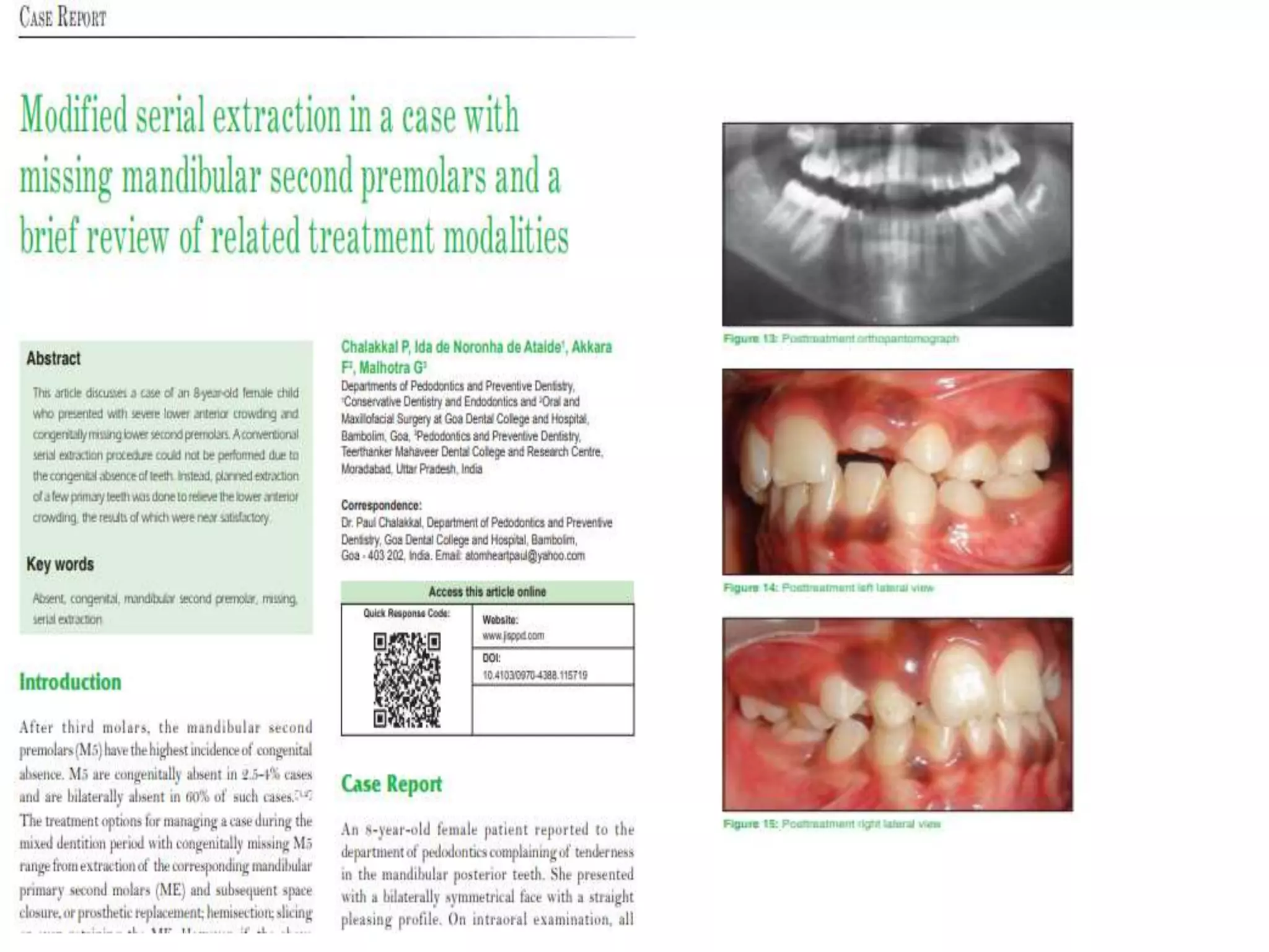 serial extraction | PPTX