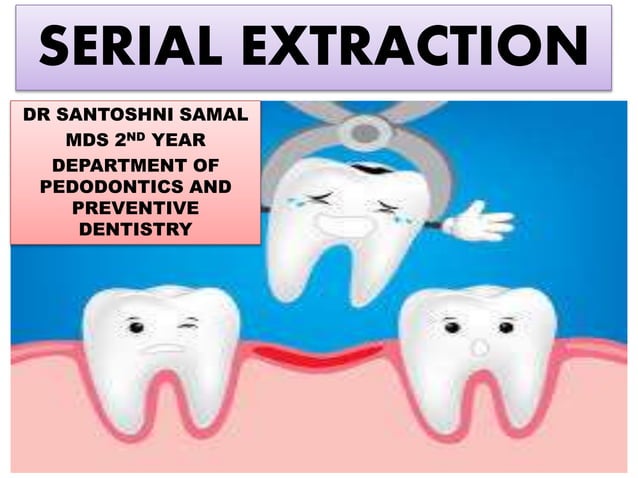 serial extraction | PPTX