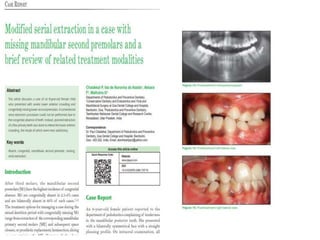 serial extraction | PPTX