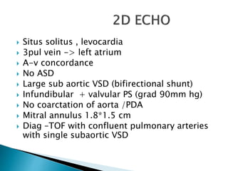 15 th april siva cath PRESENTATION , VSD / TOF | PPT