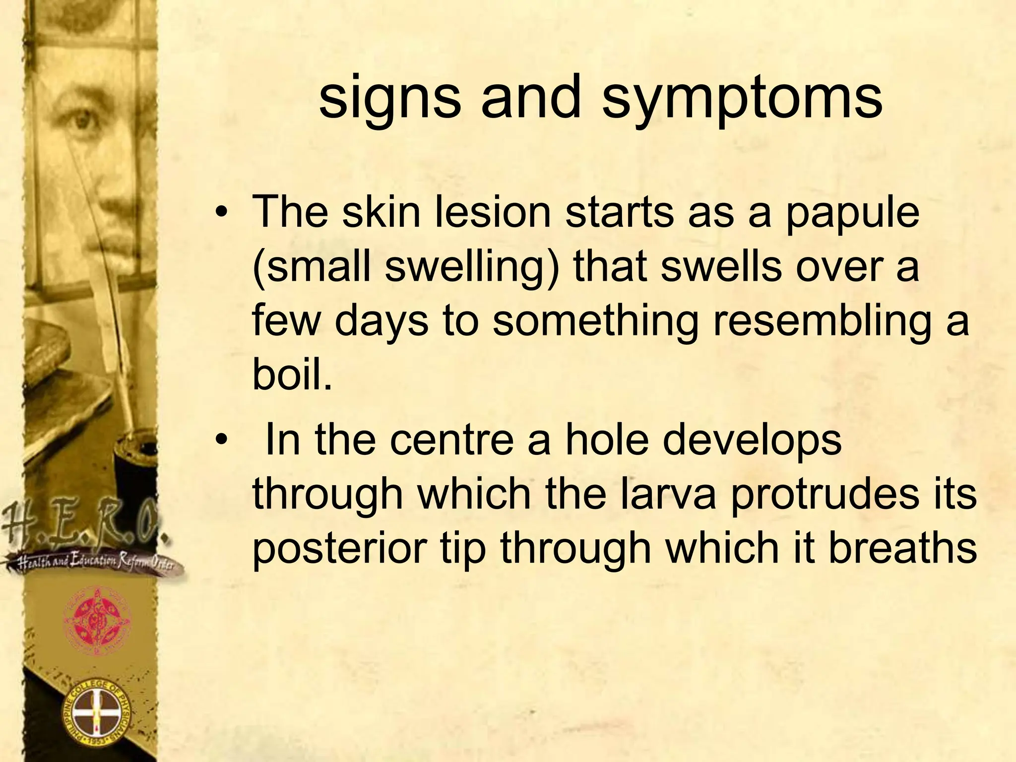 15 Tumbu fly larva.power point prensation | PPT