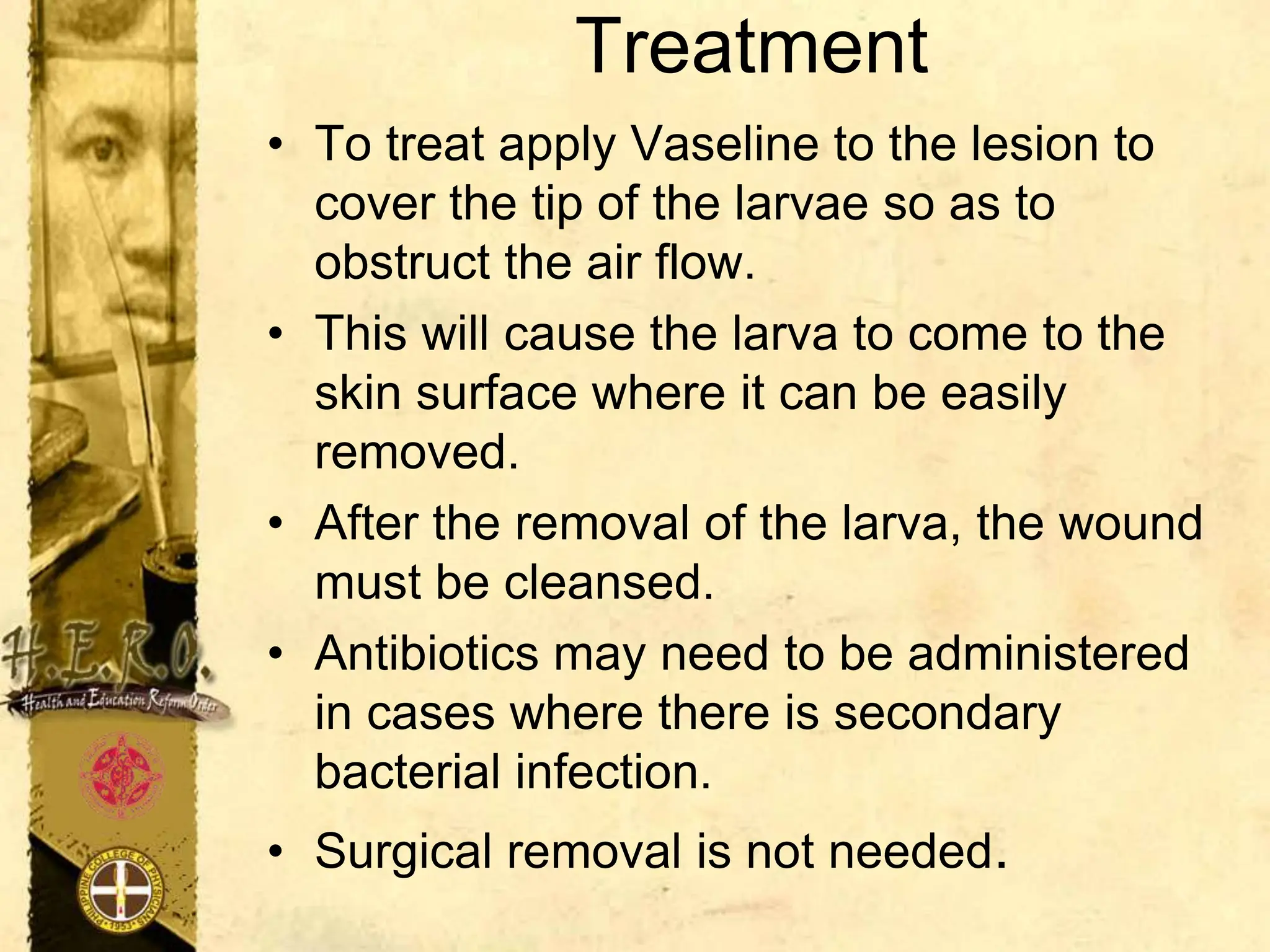 15 Tumbu fly larva.power point prensation | PPT