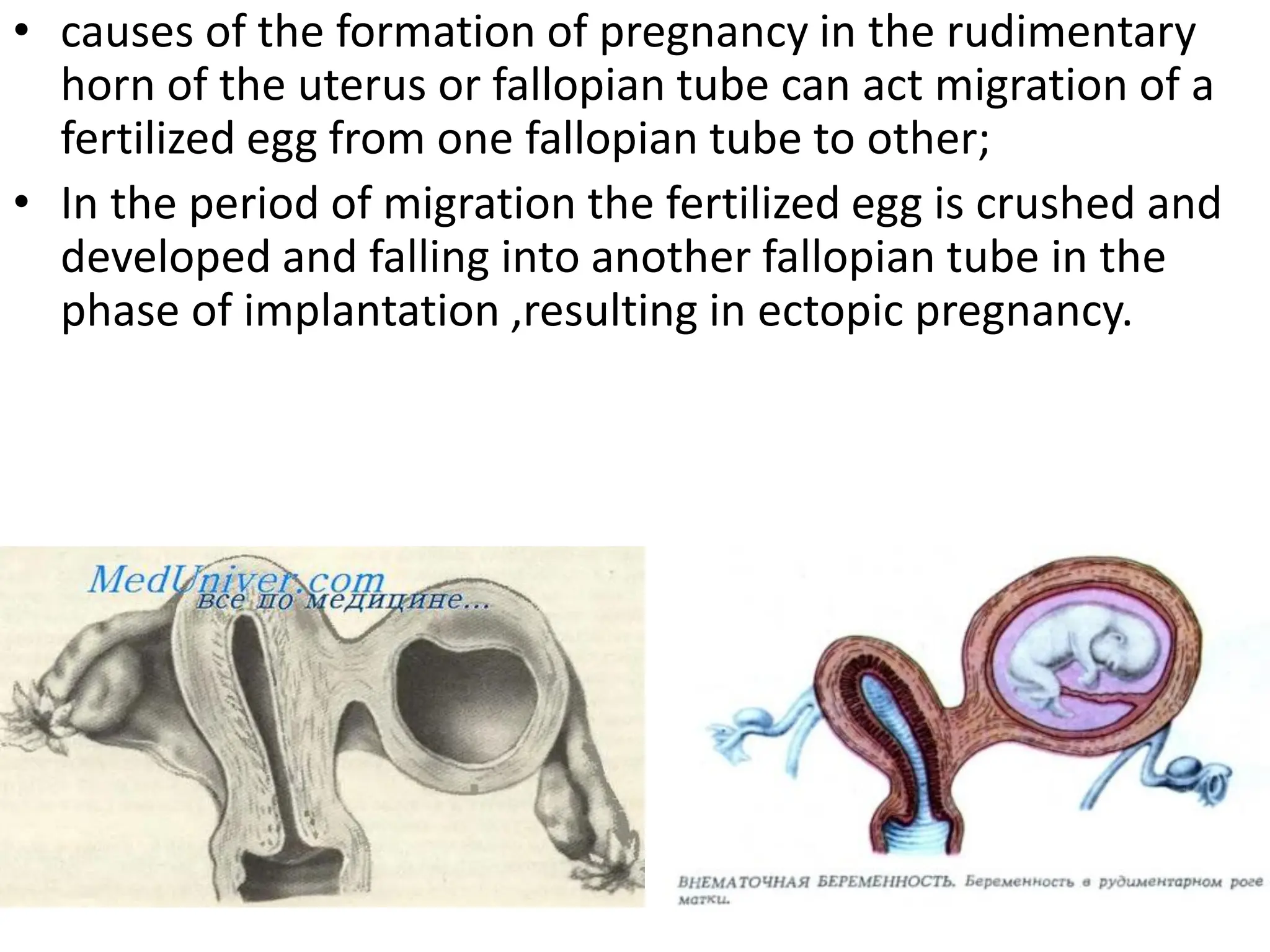 15 Urgent states in gynecology.pdf