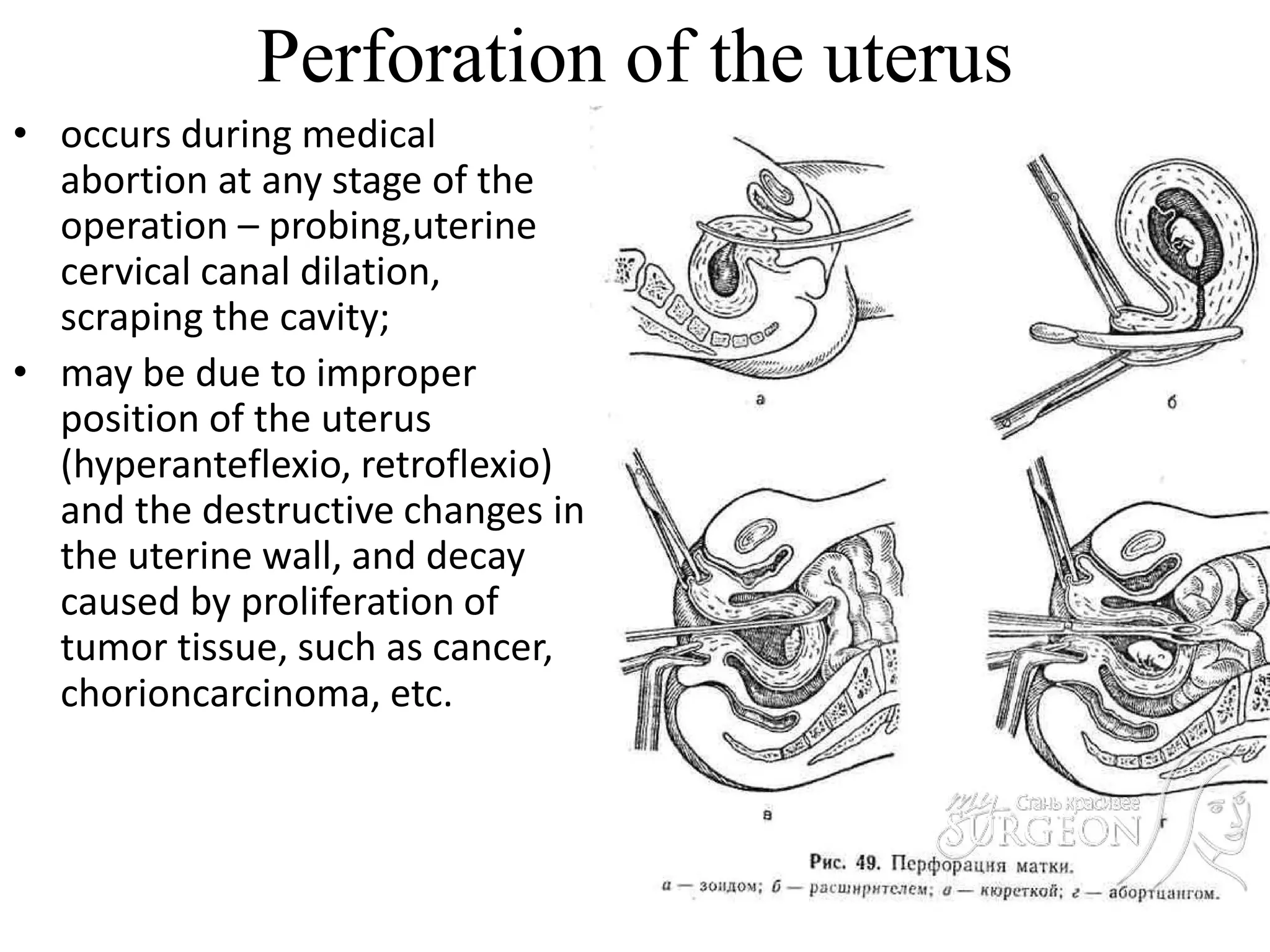 15 Urgent states in gynecology.pdf