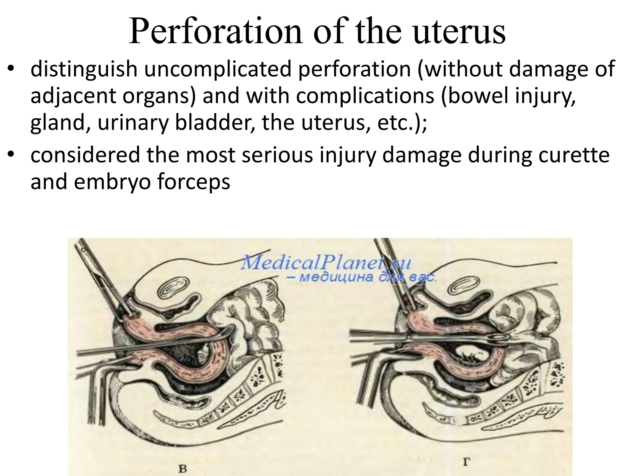 15 Urgent states in gynecology.pdf
