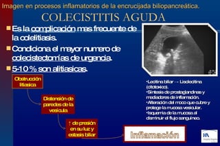 IMAGEN EN PROCESOS INFLAMATORIOS DE LA ENCRUCIJADA BILIOPANCREATICA | PPT