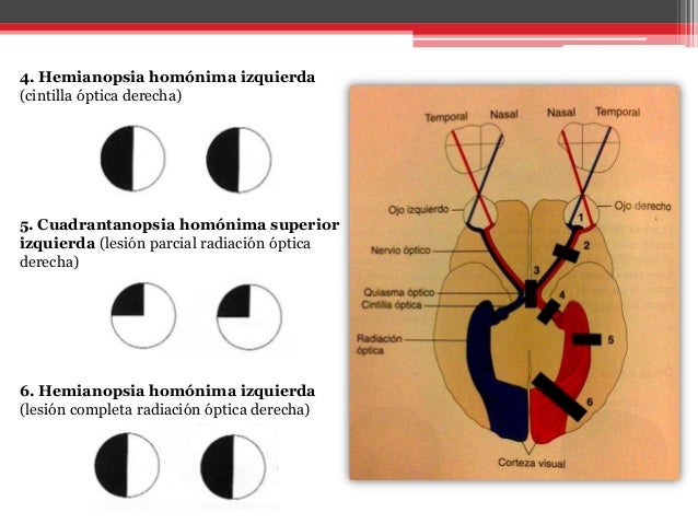 16. Exploración de Ojo (01-Oct-2013)