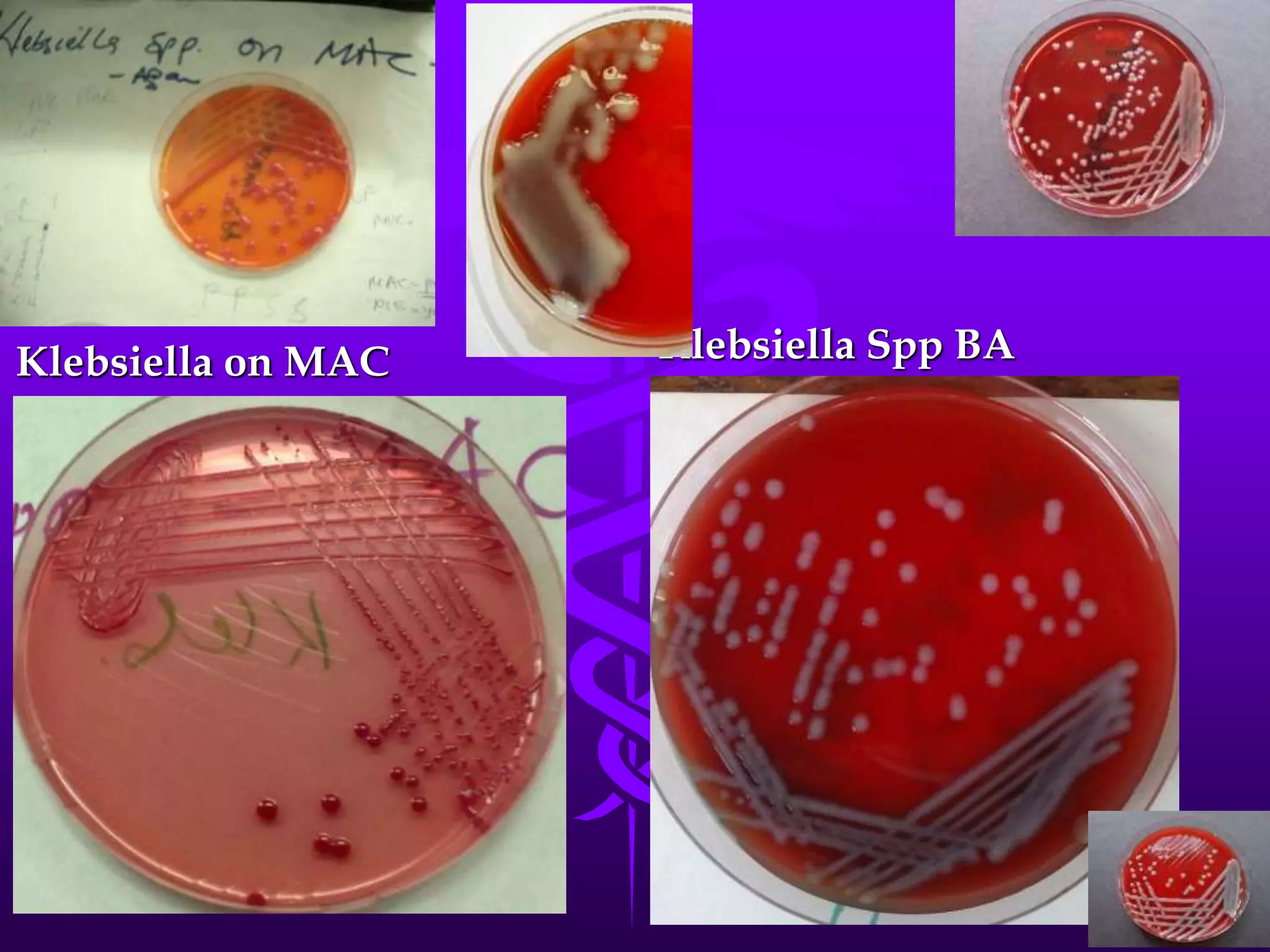 16. enterobacteriaceae | PPTX