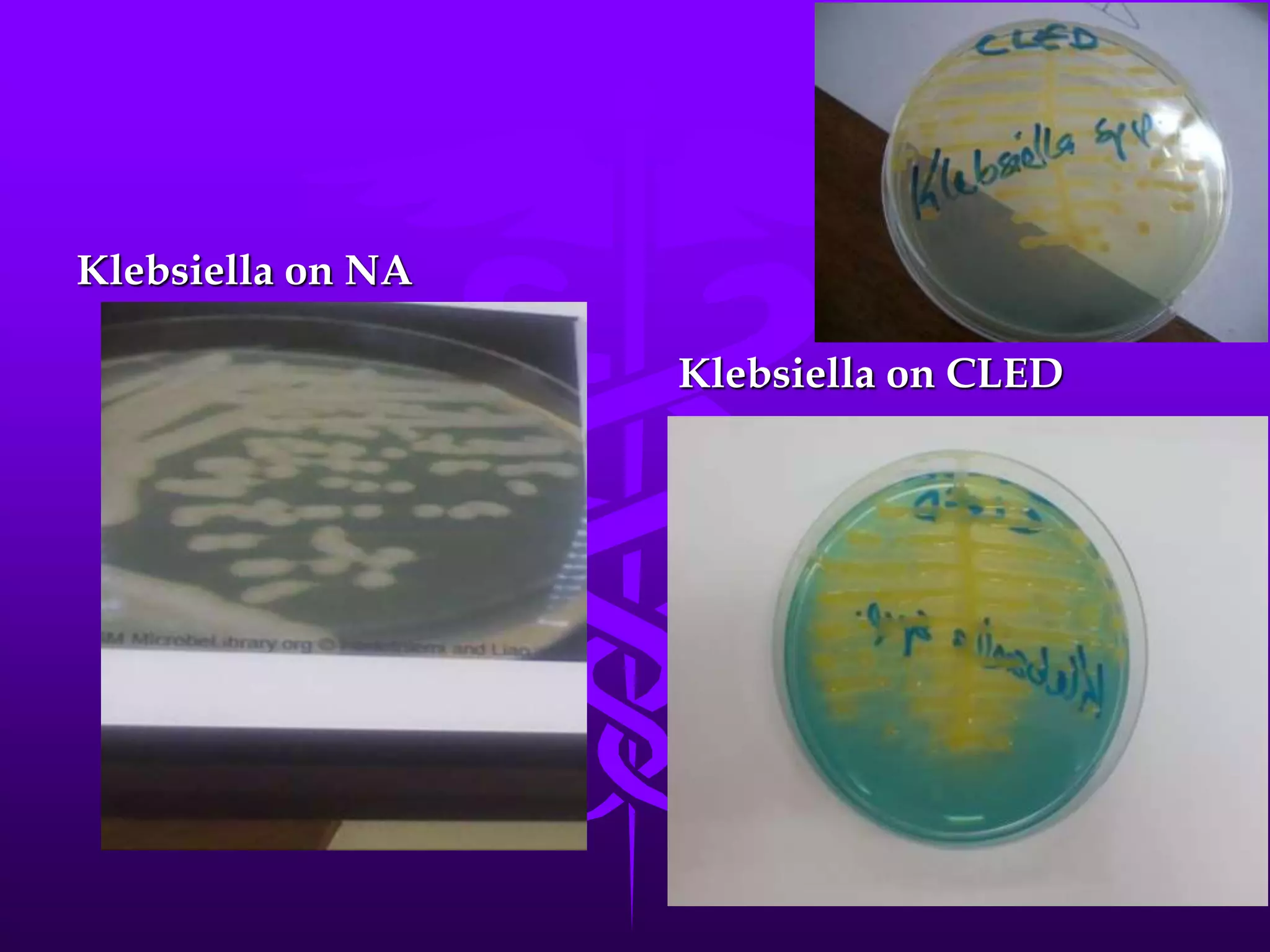 16. enterobacteriaceae | PPTX