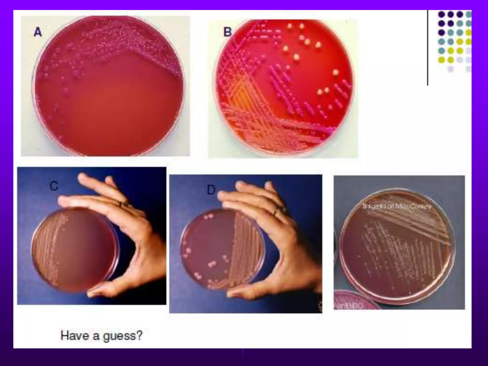 16. enterobacteriaceae | PPTX