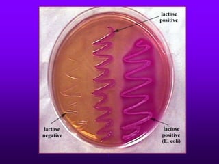 16. enterobacteriaceae | PPTX