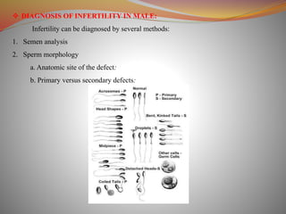 A REVIEW ON MALE INFERTILITY | PPT