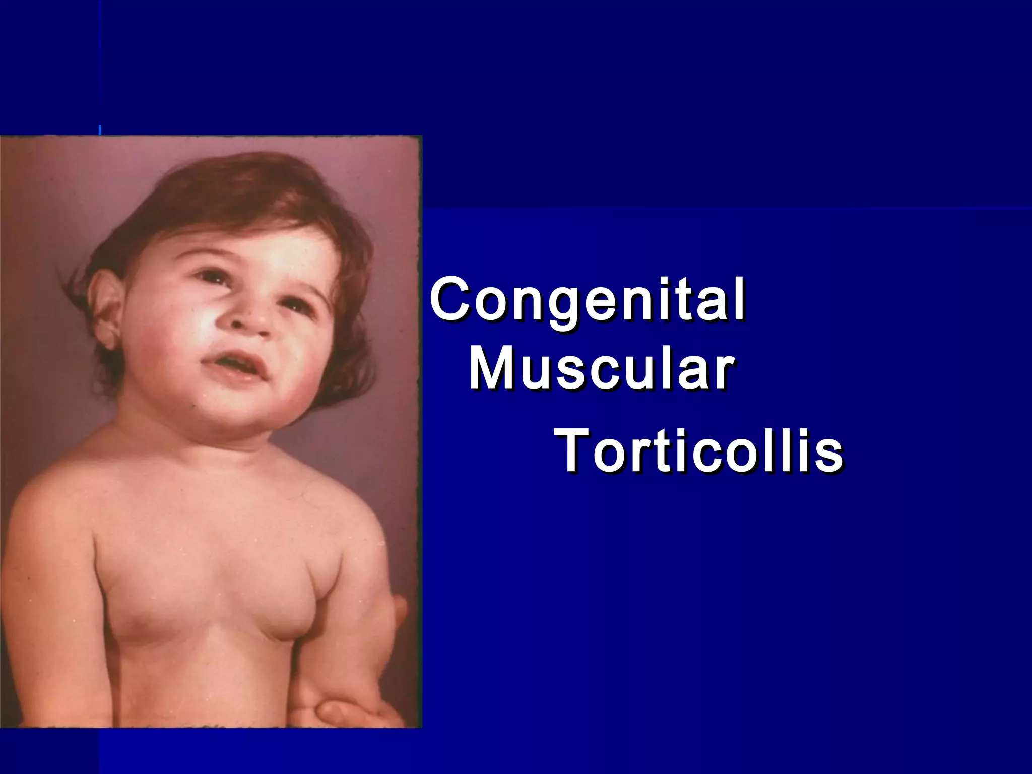 Congenital Deformities | PPT