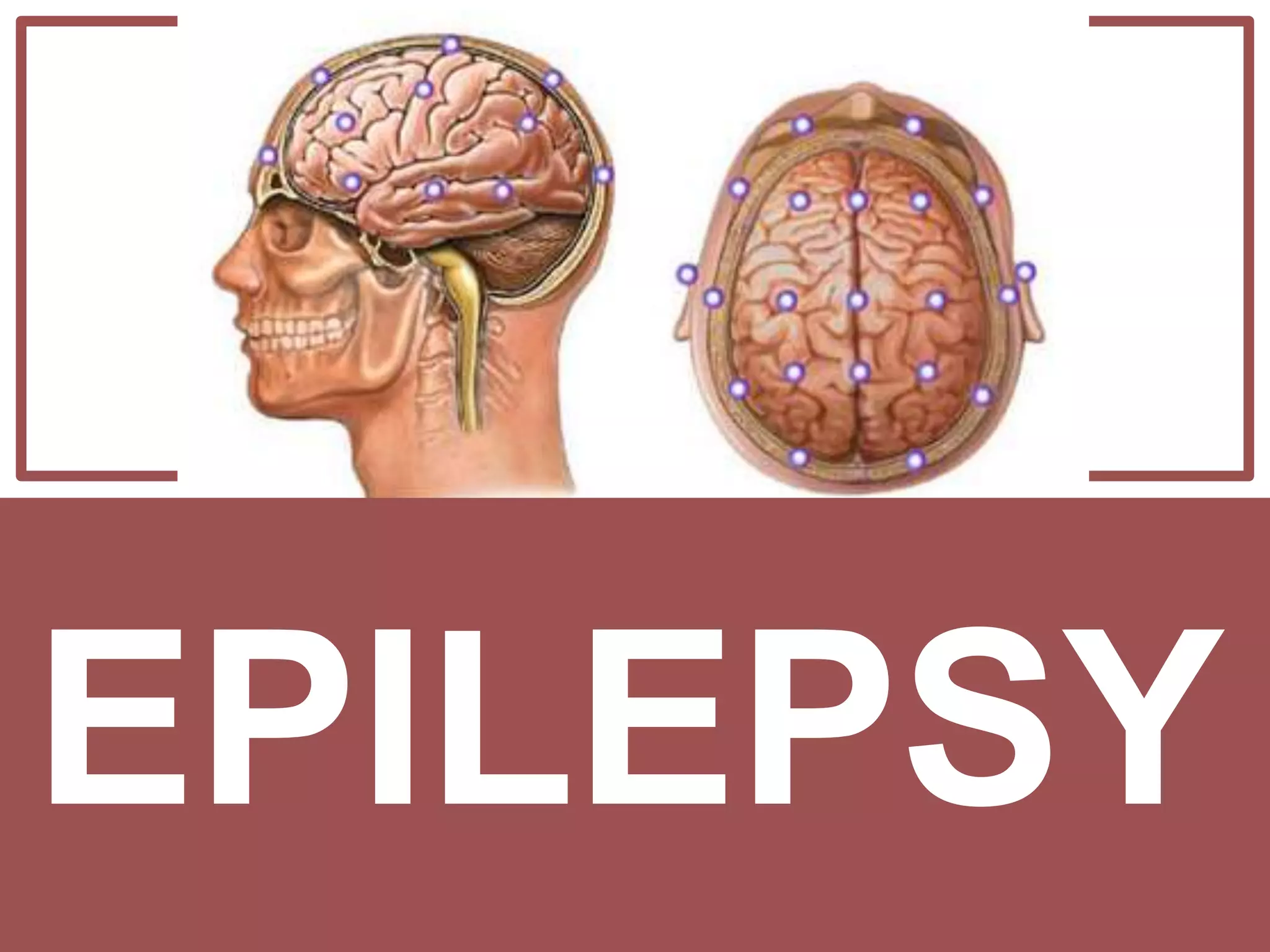 Epilepsy, headache and facial pain | PPTX