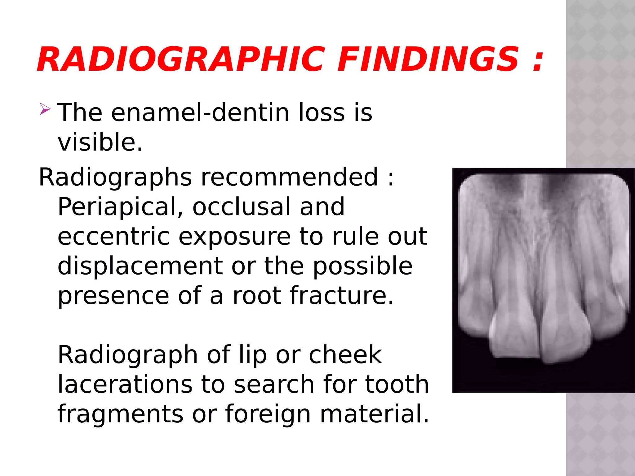 traumatic injuries to teeth | PDF