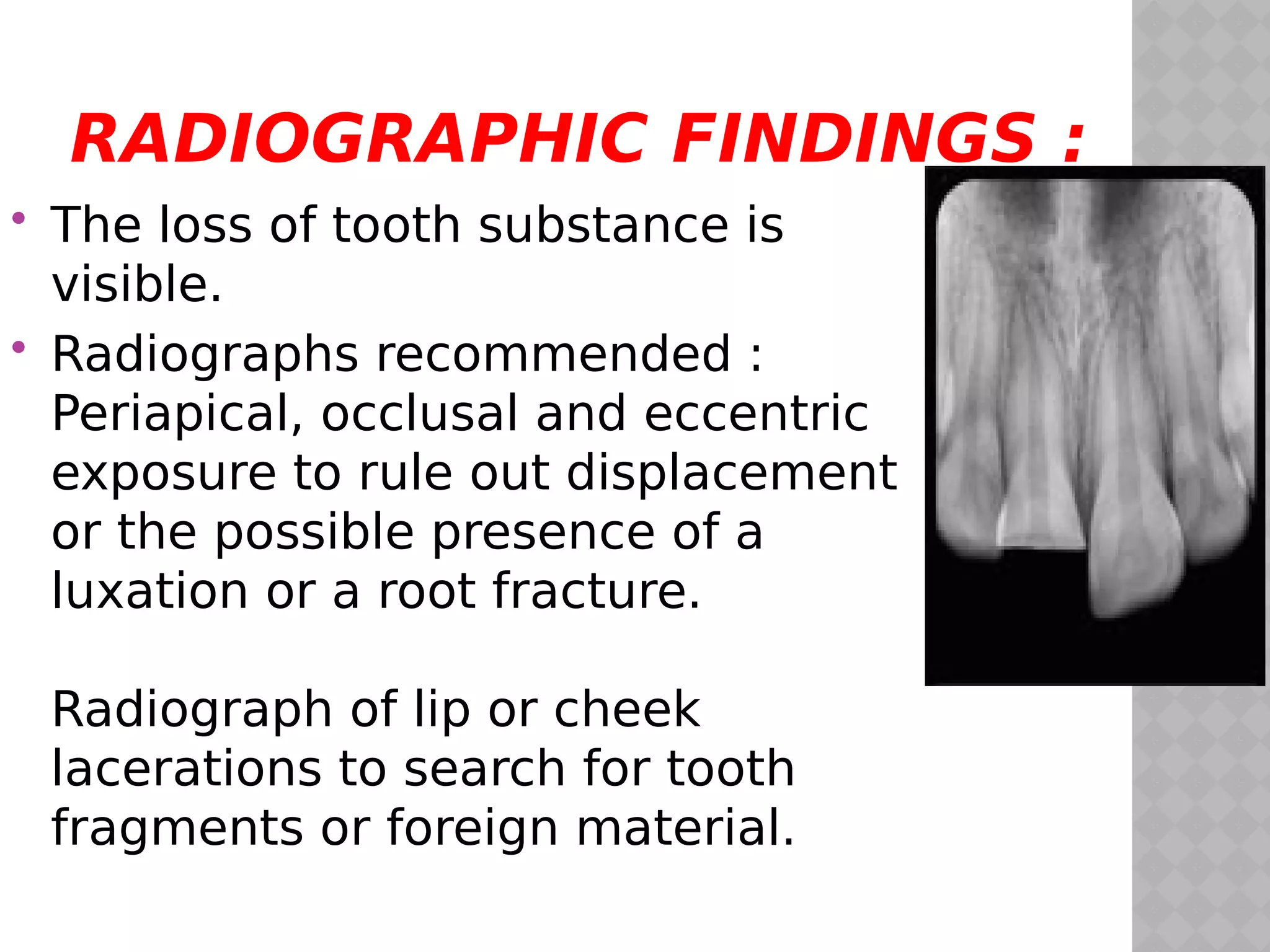traumatic injuries to teeth | PDF