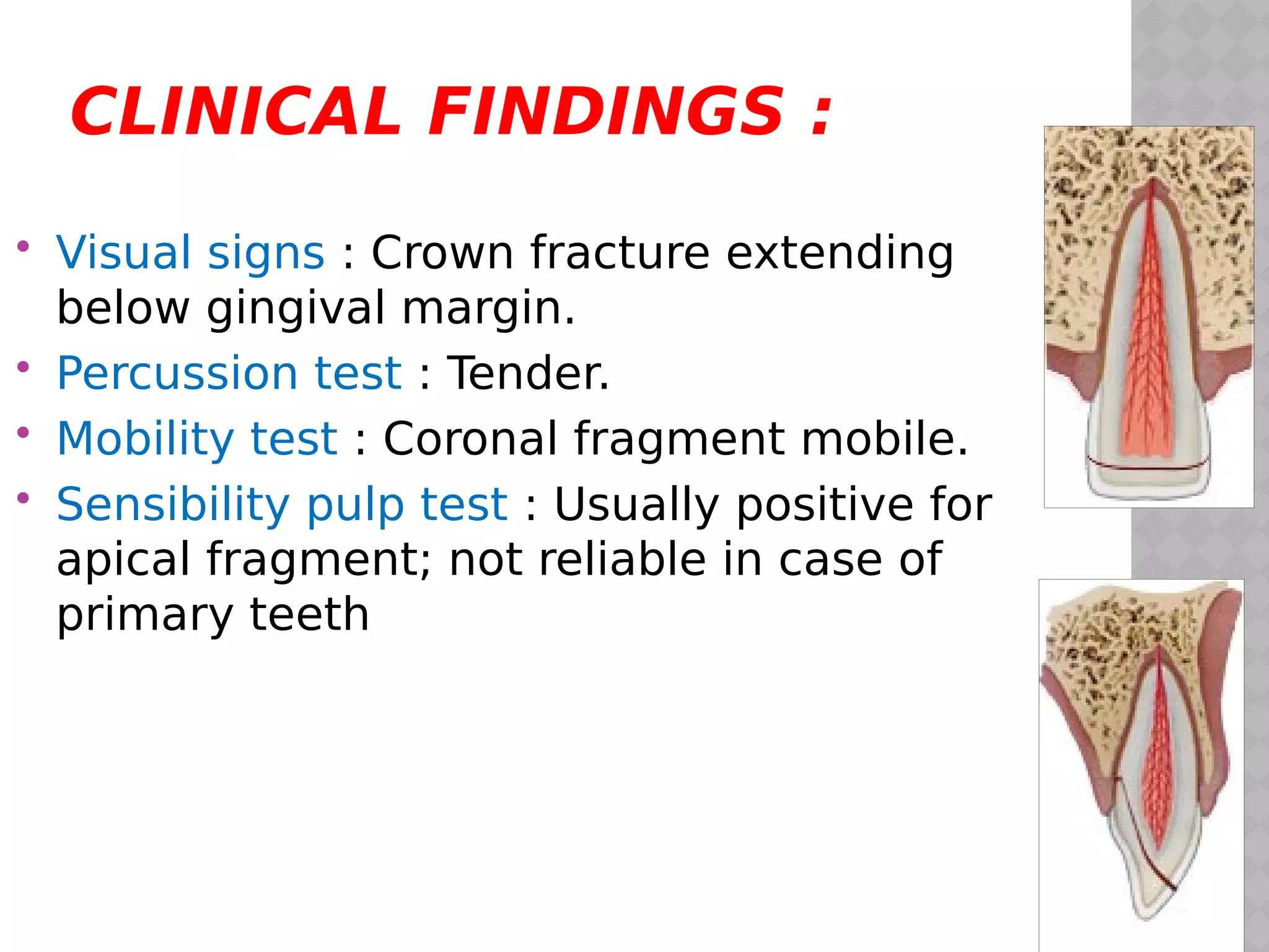 traumatic injuries to teeth | PDF