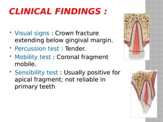 traumatic injuries to teeth | PDF